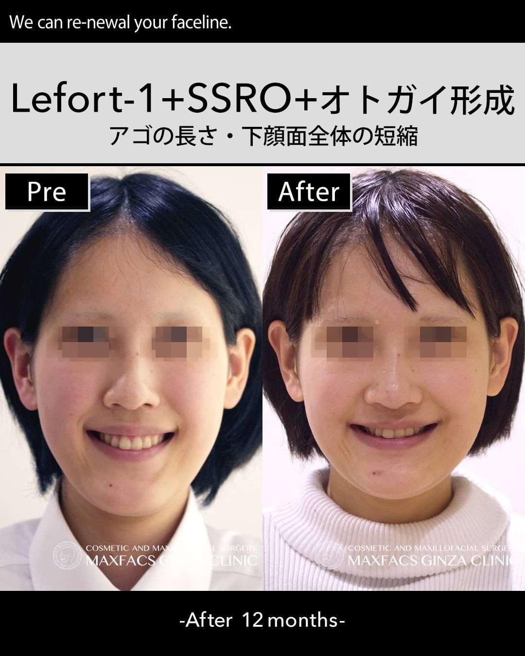 5 Recommended English-Speaking Aesthetic and Cosmetic Clinics in Tokyo ...