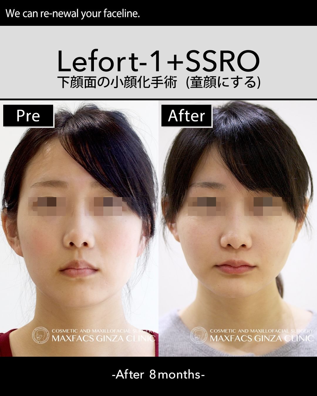 5 Recommended English-Speaking Aesthetic and Cosmetic Clinics in Tokyo ...